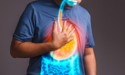 Robotic Reflux Surgery: Long-Term Relief for Chronic Acid Reflux (GERD ...